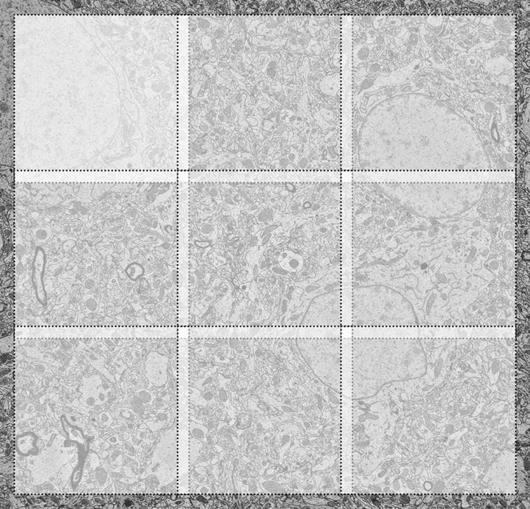 ZEISS Volutome: In-Chamber Ultramicrotome for Serial Block-Face SEM