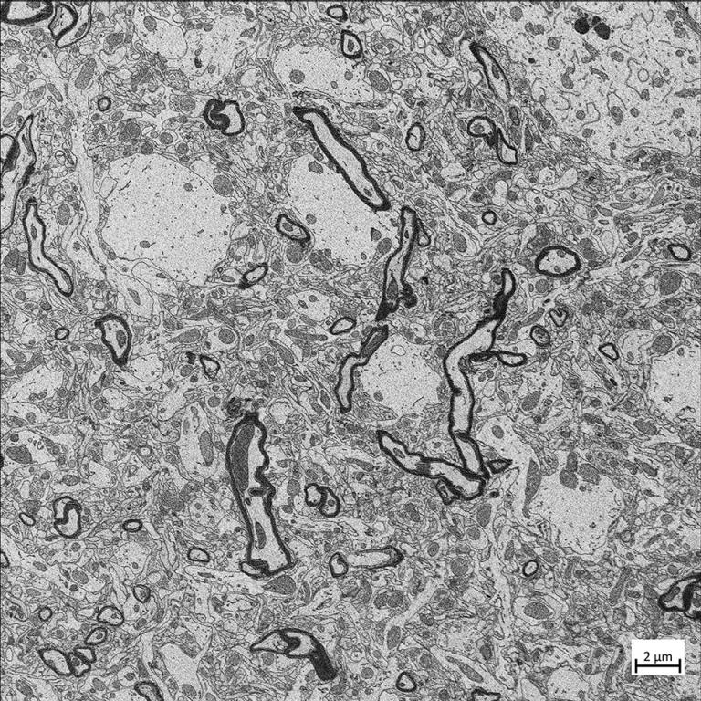 ZEISS Volutome: In-Chamber Ultramicrotome for Serial Block-Face SEM
