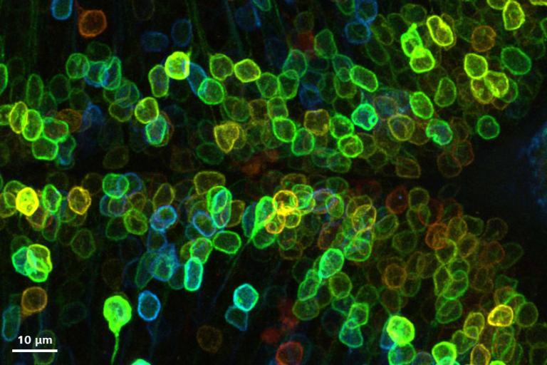 ZEISS LSM 900 with Airyscan 2 - Compact Confocal Microscope for Live ...