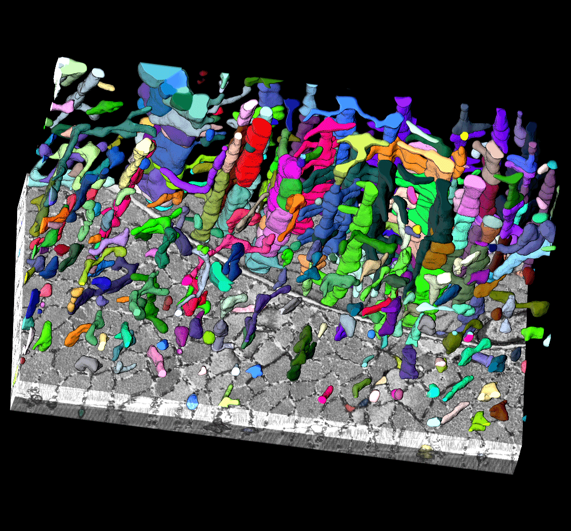 3d Volume Electron Microscopy Explores Mitochondrial And Muscle